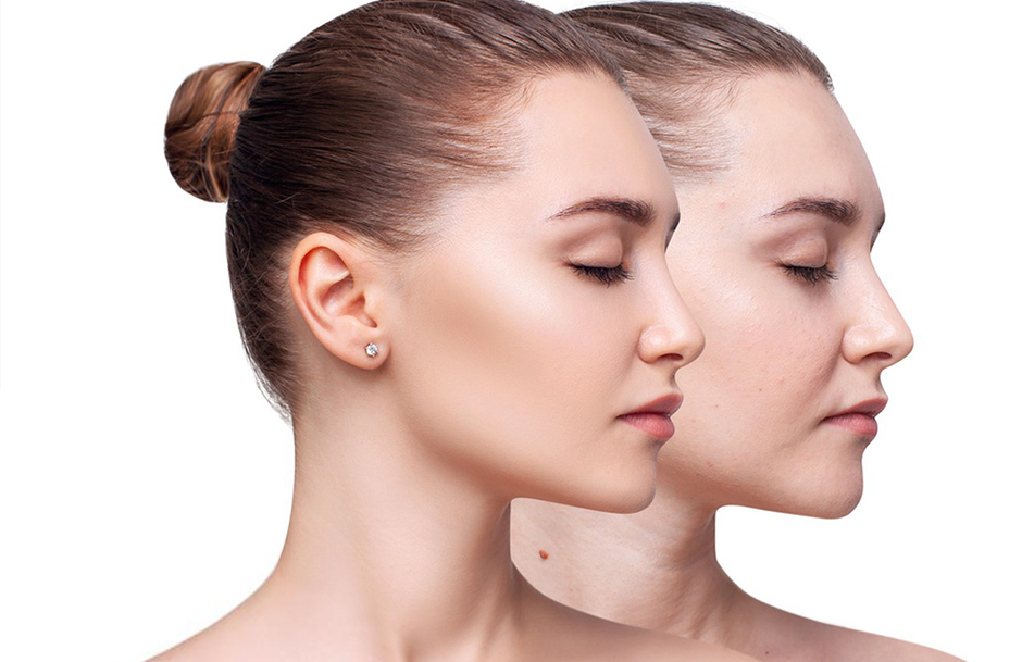 The benefits of the 7D HIFU machine treatment include: